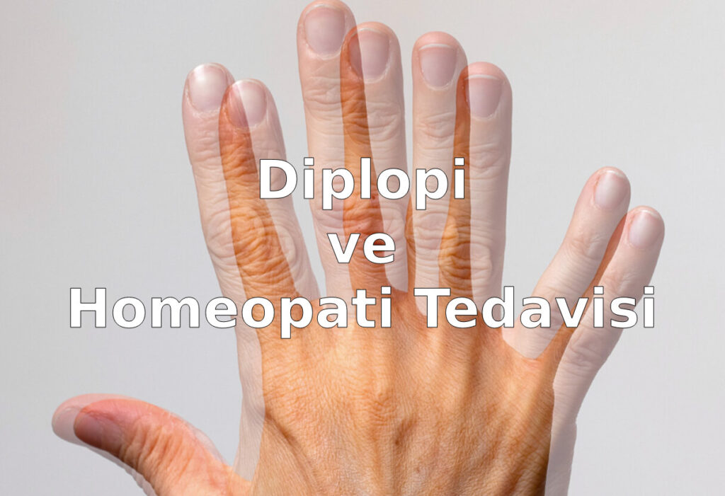 Diyabetli Bir Vakada Diplopi’nin Homeopati İle Tedavisi (Vaka Analizi ...